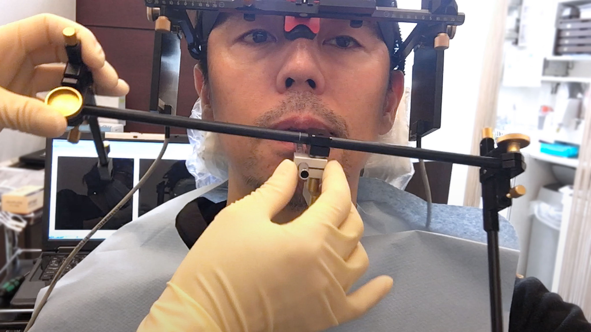 キャディアックス（CADIAX）で歯科矯正前の噛み合わせ検査をした | 歯列矯正した40代男のブログ