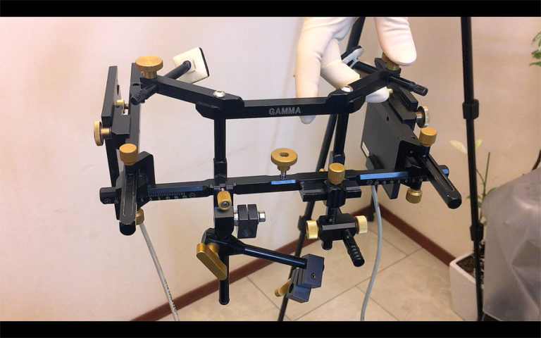 キャディアックス（CADIAX）で歯科矯正前の噛み合わせ検査をした | 歯列矯正した40代男のブログ