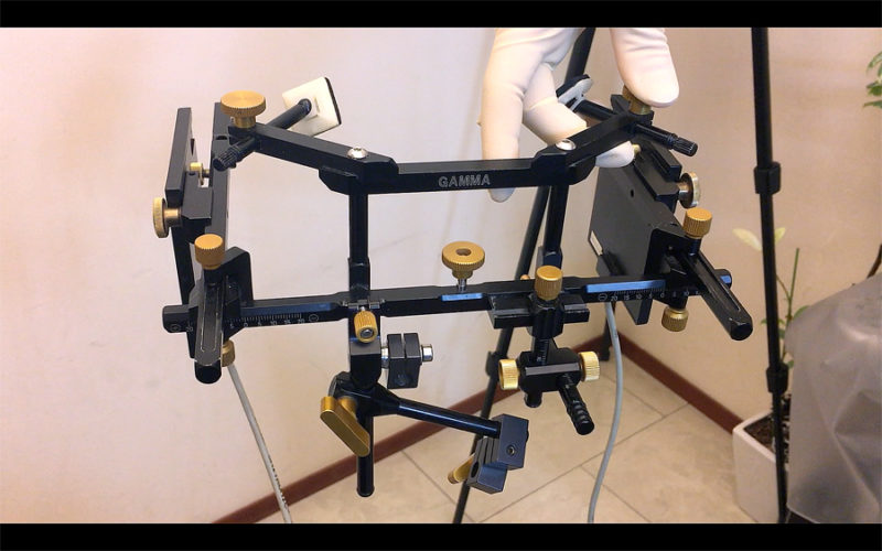 キャディアックス（CADIAX）で歯科矯正前の噛み合わせ検査をした | 歯列矯正した40代男のブログ