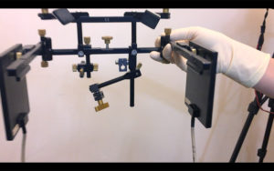 キャディアックス（CADIAX）で歯科矯正前の噛み合わせ検査をした | 歯列矯正した40代男のブログ